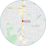 Payment Plans – Cache Valley Wisdom Teeth